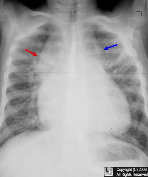 ER goldbook: Congenital heart disease I: Cyanosis