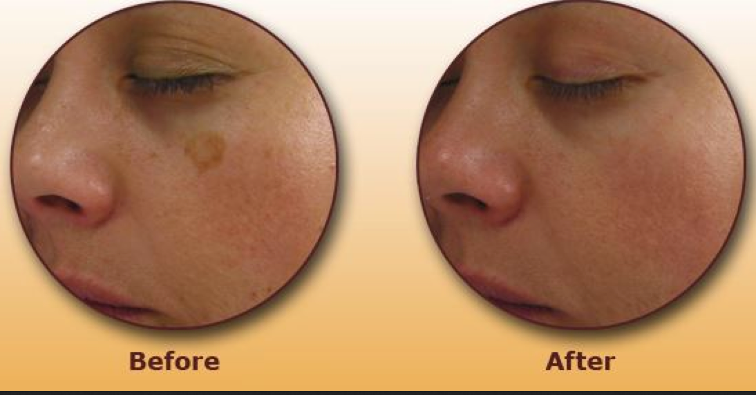 IDO'S clinic: October 2014