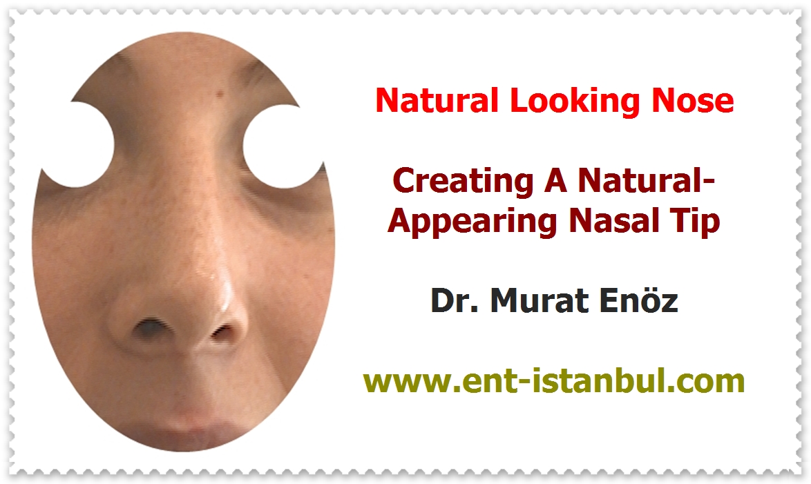 Nasal Tip Refinement: Creating A Natural Appearing Nasal Tip