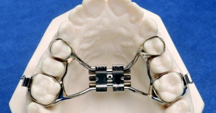 Micrognatismo. Buscador médico