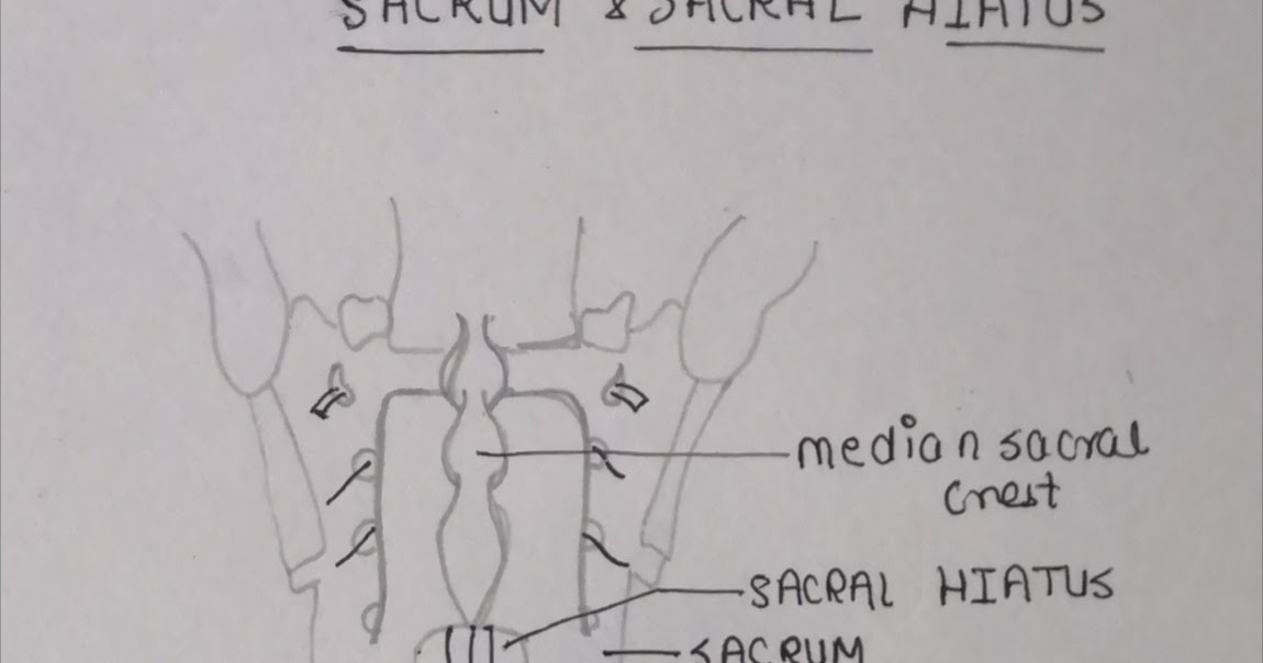 Medicowesome: Caudal anaesthesia
