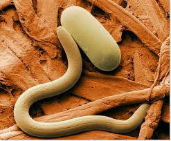 Asuhan keperawatan Teori Helminthiasis Lengkap - askep