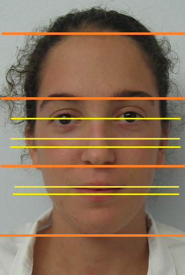 Dentistry: Facial Analysis