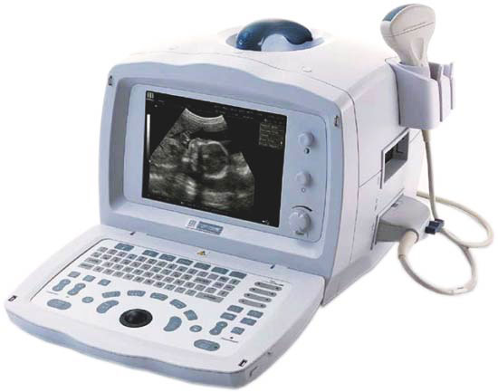 Teknologi Kesehatan: ULTRASONOGRAPHY (USG)