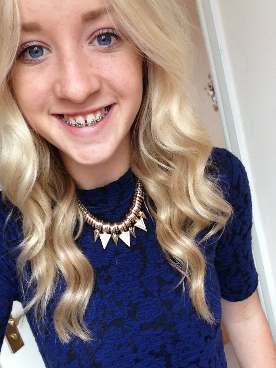 Hannah Malone: Braces - My Story