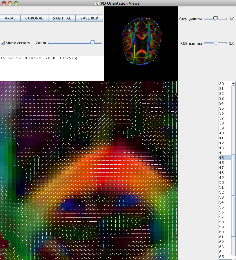 DTI Quality Control - Part 2: Tensor fitting | Diffusion Imaging; Introduction, tutorials and ...