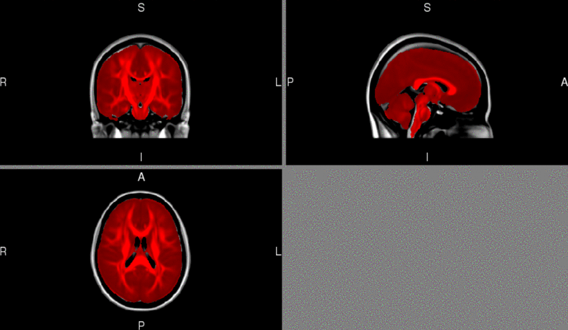 Diffusion Imaging; Introduction, tutorials and background on diffusion ...