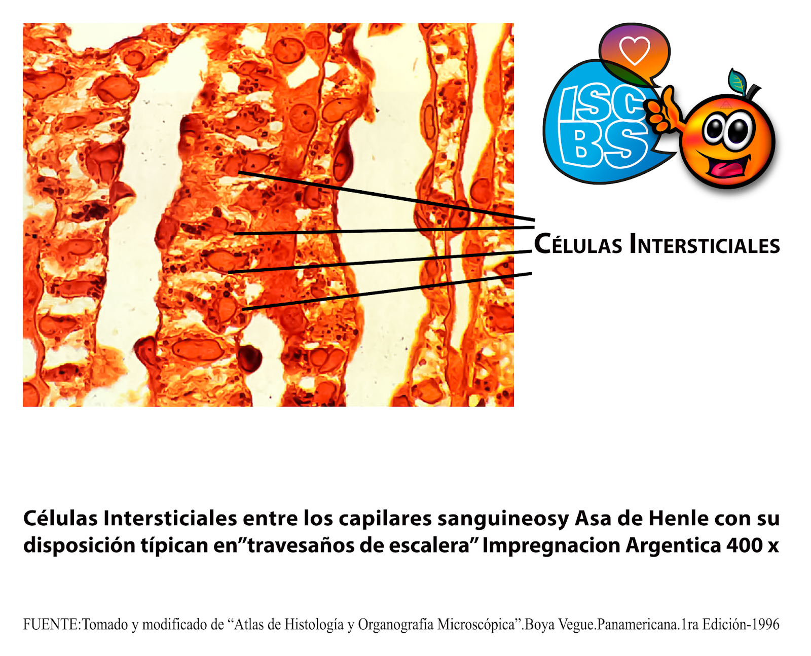 ¿Qué es el Intersticio renal?
