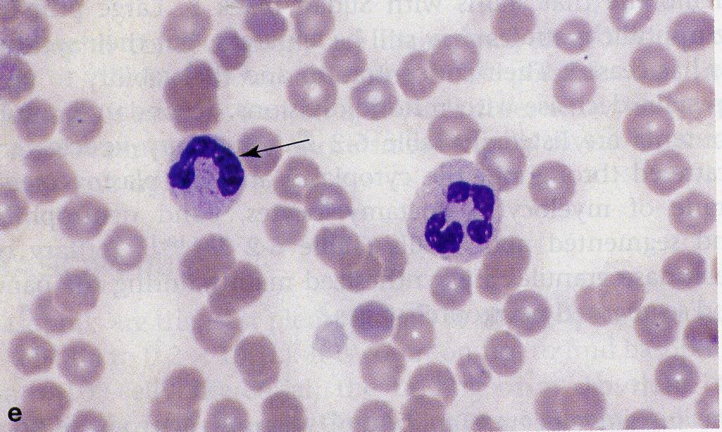 células sanguineas: Fichero de Hematología