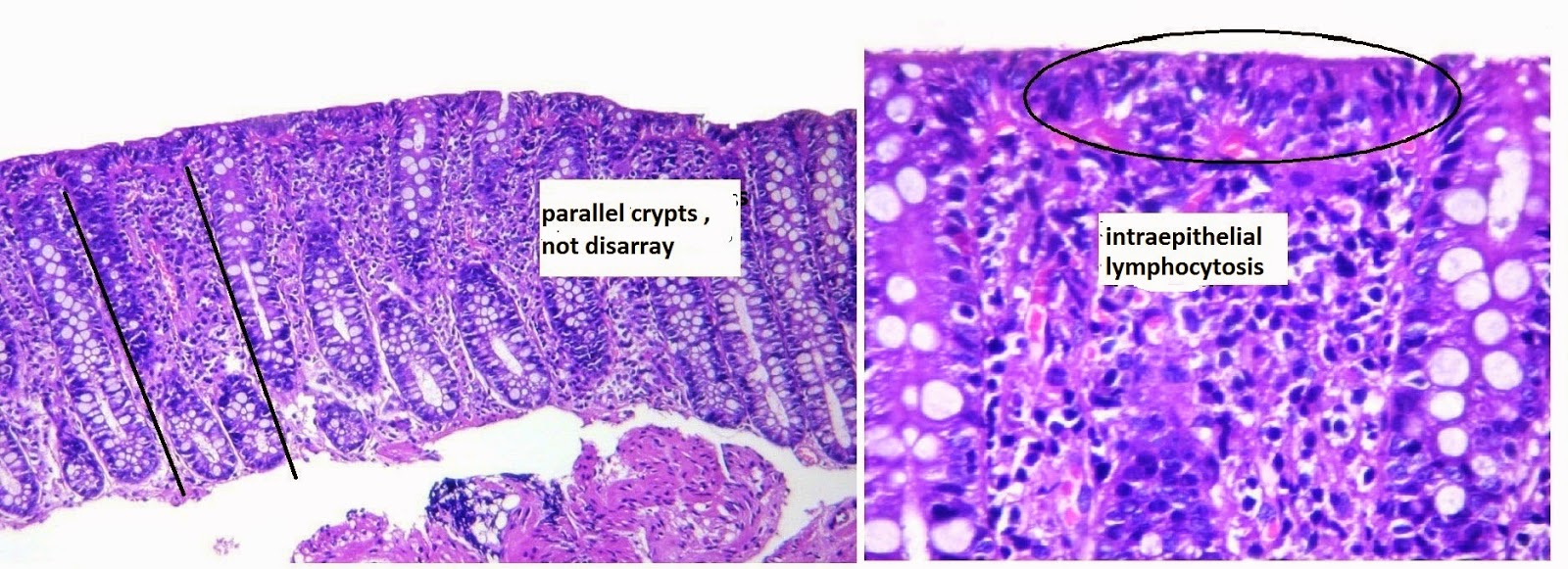 GASTROINTESTINAL AND LIVER HISTOLOGY PATHOLOGY ATLAS: August 2014