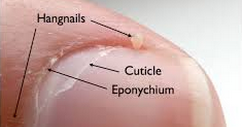VBP International: Eponychium VS Cuticle