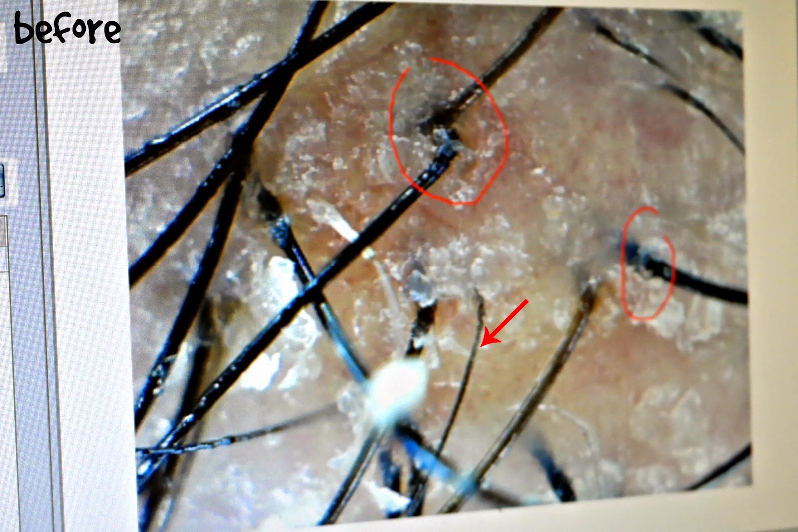 Herbal Scalp Treatment at Luxe Scalp Specialist