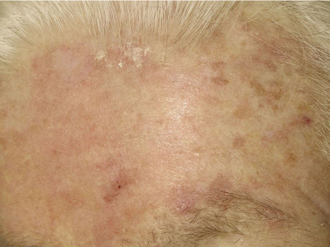 Clinica Dermatologica Dr. Edgardo Rodriguez Vallecillo