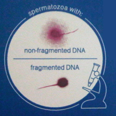 Analisa Sperma: Uji Fragmentasi DNA
