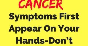 Cancer Symptoms First Appear On Your Hands-Don’t Ignore Them - WARM UP