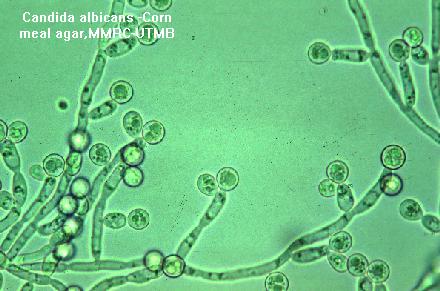 Ortomolecular: La candidiasis y sus nuevos tratamientos