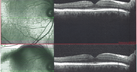 Real Psychiatry: Eye Clinic Follow Up