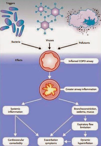 COPD exacerbation - definition, assessment, management