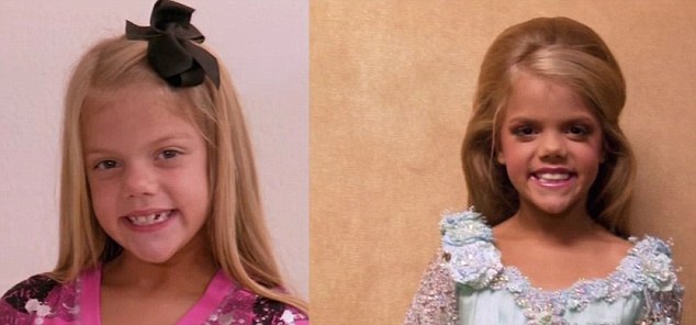 children beauty pageant fake teeth