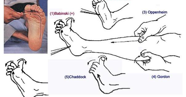 Causes of radiofemoral delay - vsaprint