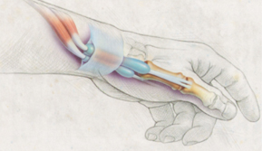 Mãos à massa! - O blog da massoterapia: Tenossinovite