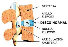Disco Intervertebral – Blog de Fisioterapia