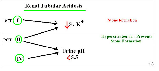 MedicoNotebook: Renal Tubular Acidosis