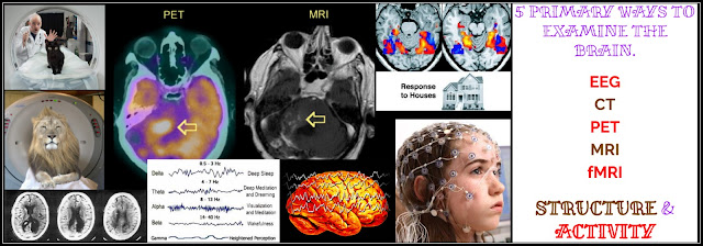 AP Psychology @AHS: 2:BIO