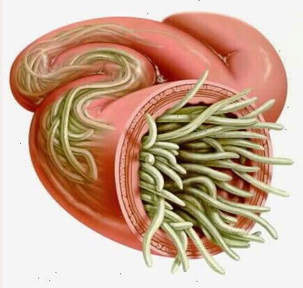 Farmacia Antonio Busto Cuíñas: Lombrices intestinales, síntomas y consejos