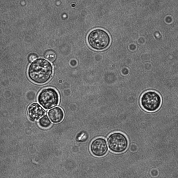 Yeast Culture