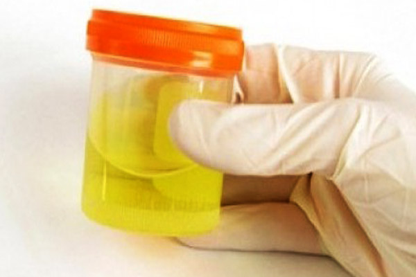 Ini alasannya, Kenapa air Kencing Berwarna kuning? | setujukan?