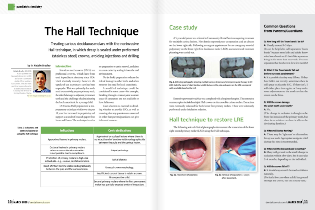 Dentaltown Article: The Hall Technique - TOOTH GERM
