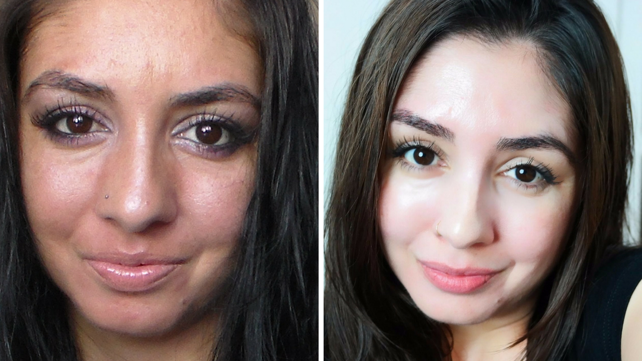 Blog da Moa: Manchas de pele - O que é glicação? falando sobre diminuir ...