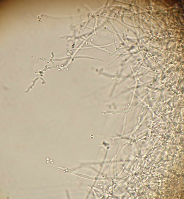 ATLAS MICOLOGIA: TRICHOPHYTON MENTAGROPHYTES