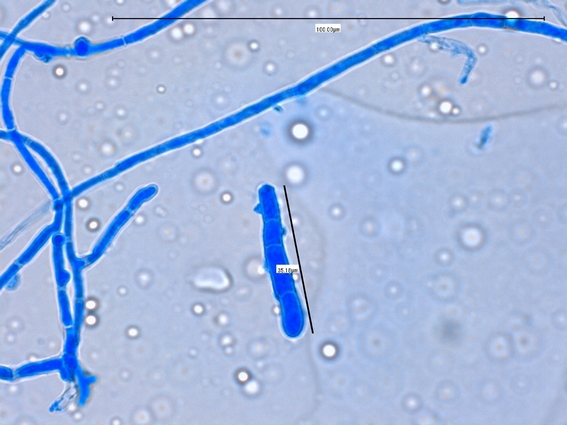 Fun With Microbiology (What's Buggin' You?): Epidermophyton floccosum