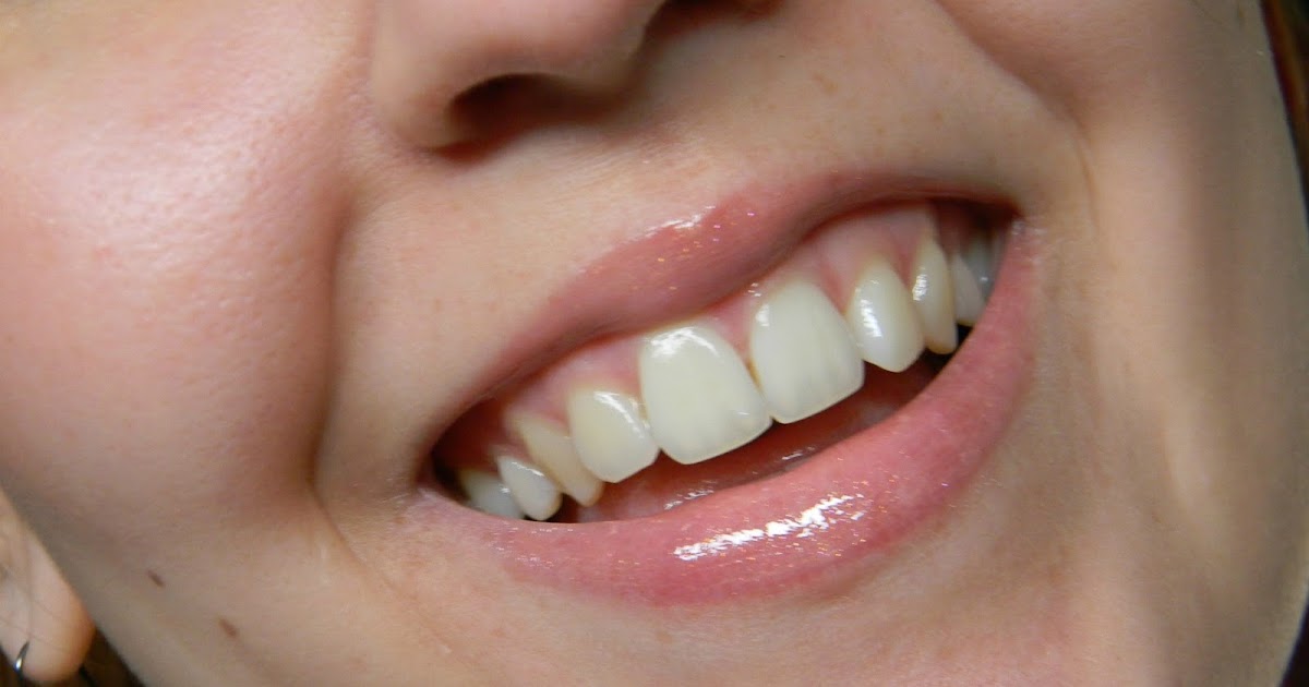 TIPS VOOR EEN GEZONDE GEBIT | Beauty Treasures