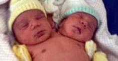Conjoined Twins Born In Brazil With TWO HEADS!