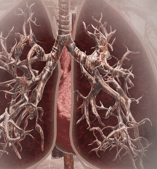 Everything about Radiology: Perbedaan perokok vs non perokok