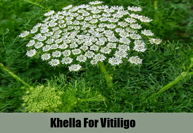 5 USEFUL HERBAL REMEDIES FOR VITILIGO ~ Mzizi Mkavu