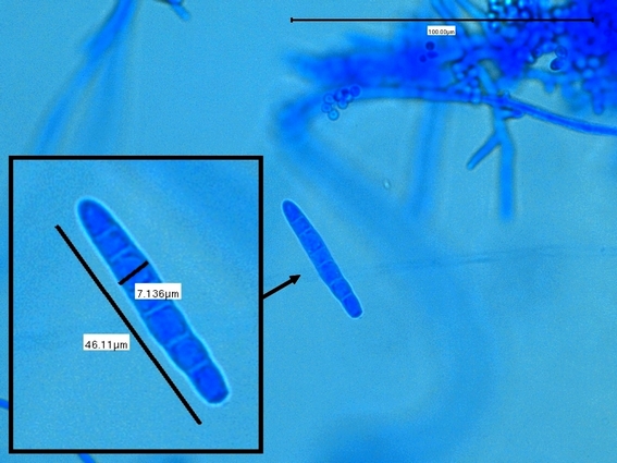 Fun With Microbiology (What's Buggin' You?): Trichophyton ...