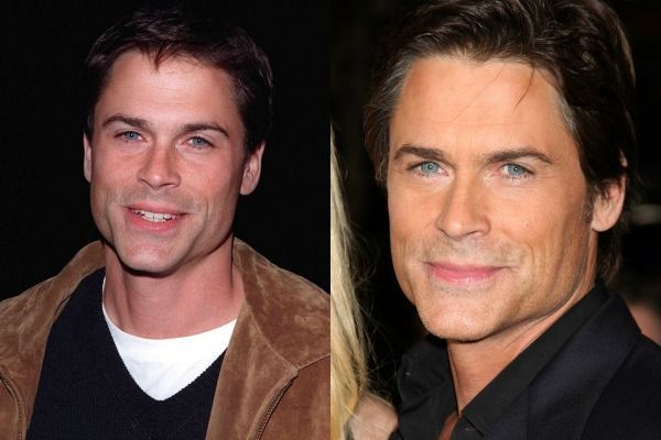 Rob Lowe Plastic Surgery