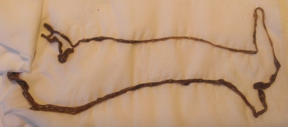 Poletka zdrowia: PASOŻYTY, PASOŻYTY: ROPE WORM WSZYSCY GO MAJA!!!