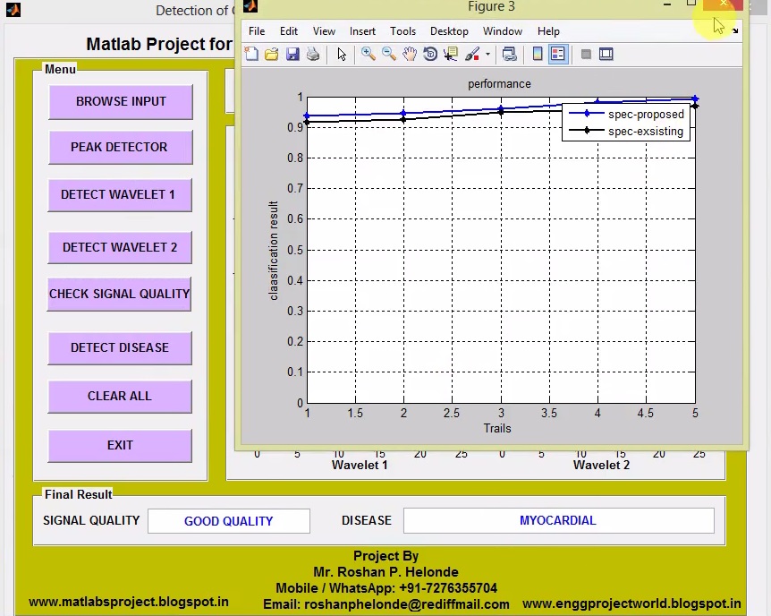 Detection of Cardiac Disease from ECG Signal Matlab Project with Source Code || IEEE Based ...