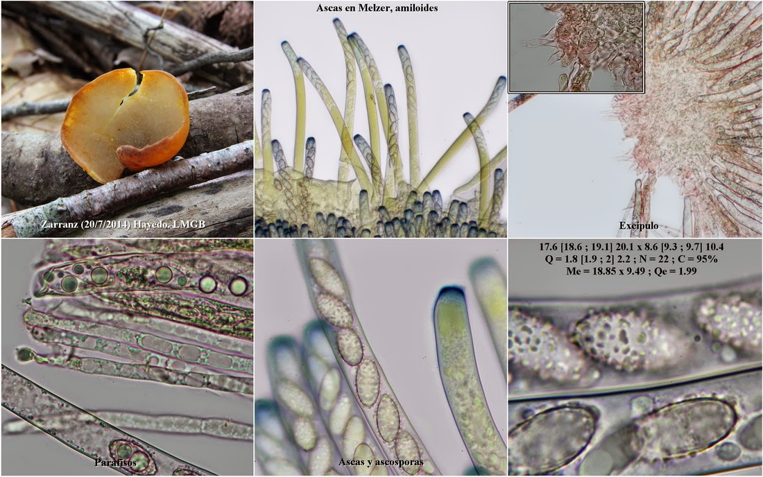 Microscopía de hongos. Vol 4. O - R: Peziza succosa