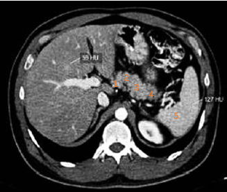 Actividad 5 - Evaluacion Final - Grupo 154003_9: 4. Tórax y Abdomen