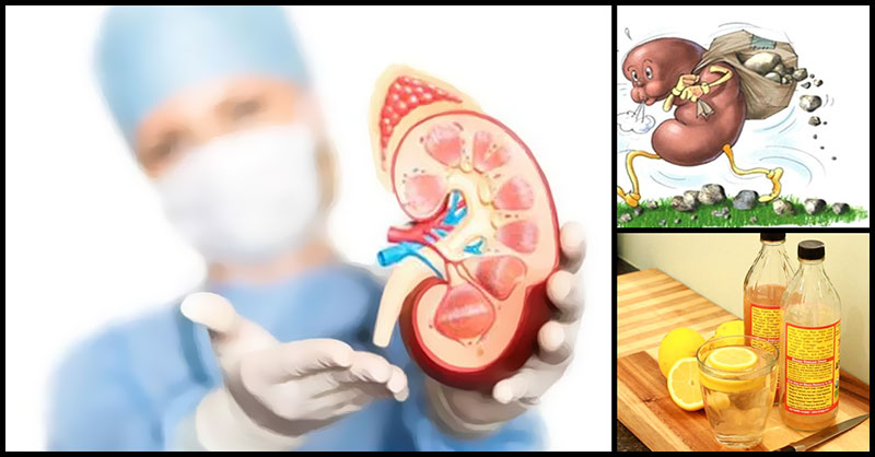Healthy Ways To Naturally Cleanse The Kidneys | Dr Farrah MD