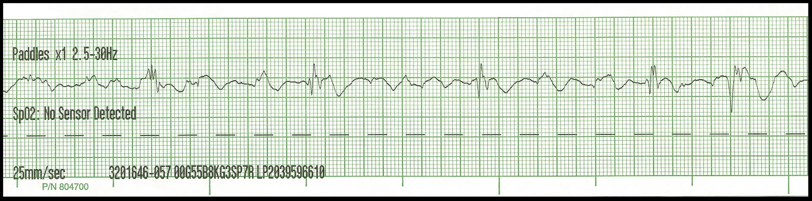 Code Blue: Shop till you drop