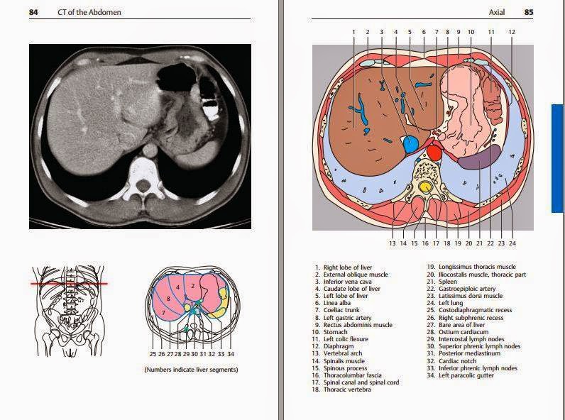 Giáo Trình + Atlas CT Scan ~ Y Học Thực Hành
