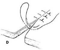 Enfermer@ en Urgencias y UCI : octubre 2015