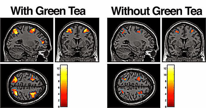 Life Changing Health News: GREEN TEA IMPROVES BRAIN CONNECTIONS